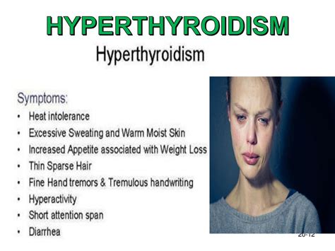 Endocrine Systems Use Of Thyroid Hormone To Control Overall Metabolism Ppt Download