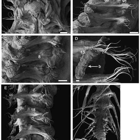 Nephtys Bangladeshi N Sp Sem Photographs A Dorsal View Of Anterior Download Scientific
