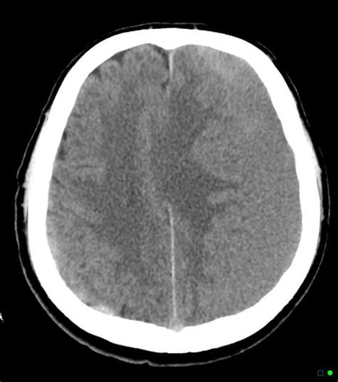 Pin On Radiopaedia