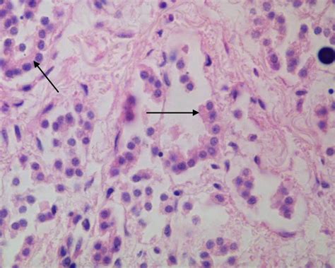 Fetal Autopsy Thyroid The Autopsy Book