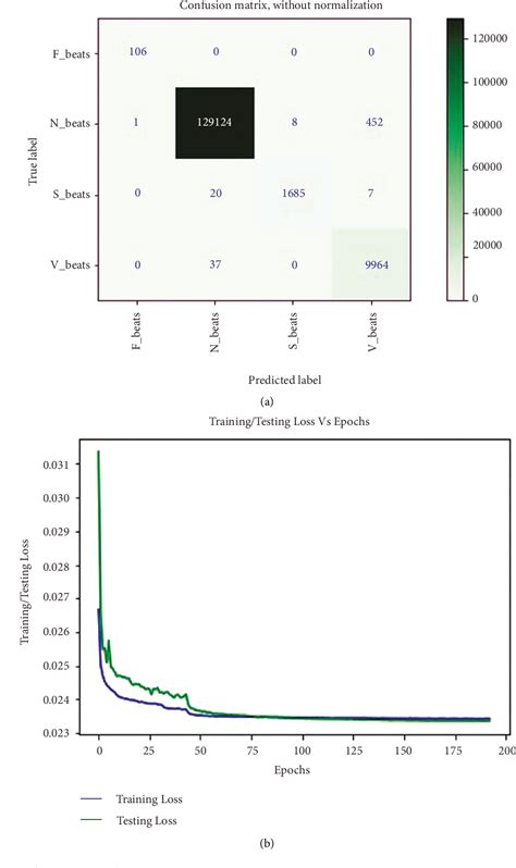 Figure 6 From An End To End Cardiac Arrhythmia Recognition Method With