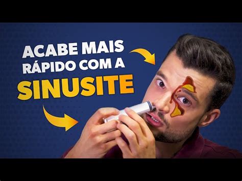 Sinusite Aguda O Que Sintomas Causas E Tratamento Tua Sa De