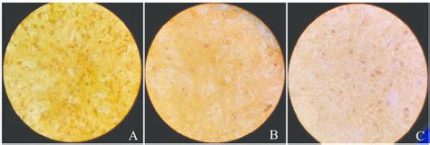 The Inclusions Viewed Under The Microscope ˆ200 By Iodine Dye The Download Scientific