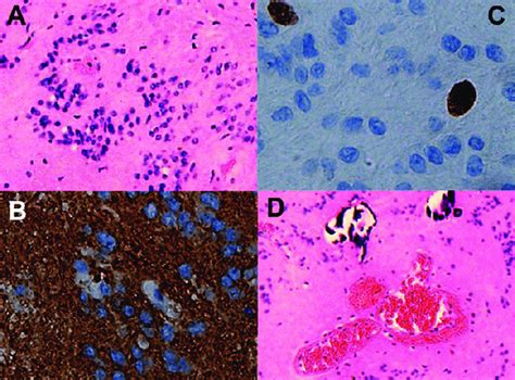 A Represents Clusters Of Isomorphic Nuclei Embedded In A Dense