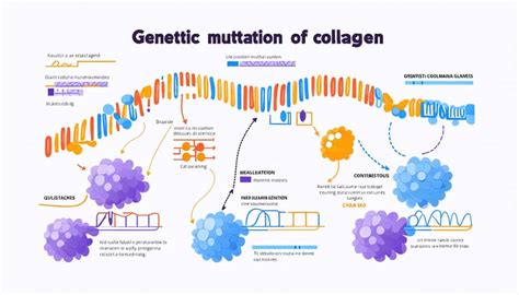 Brittle Bone Disease Chromosome Mutation At Latoya Zell Blog