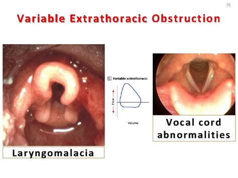 Copd Diagnosis Differential Diagnosis 1 Dr Mazen Qusaibaty