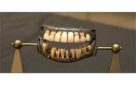 Evolución De La Odontología Restauradora Figueroa Lizbeth Timeline T