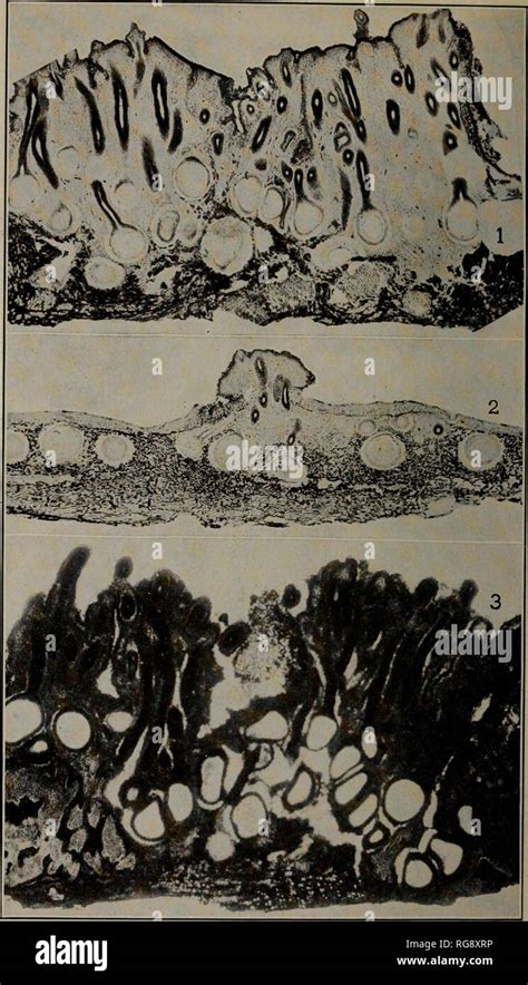 Bulletins On Forest Pathology From Bulletin Usda Washington
