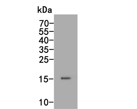 Cdkn1a P21 Polyclonal Antibody Ha500156