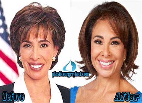 Jeanine Pirro Plastic Surgery Before And After Pictures