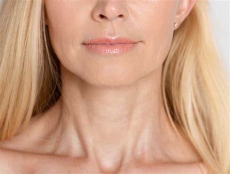 Difference Between Normal Neck And Goiter Difference Between Normal