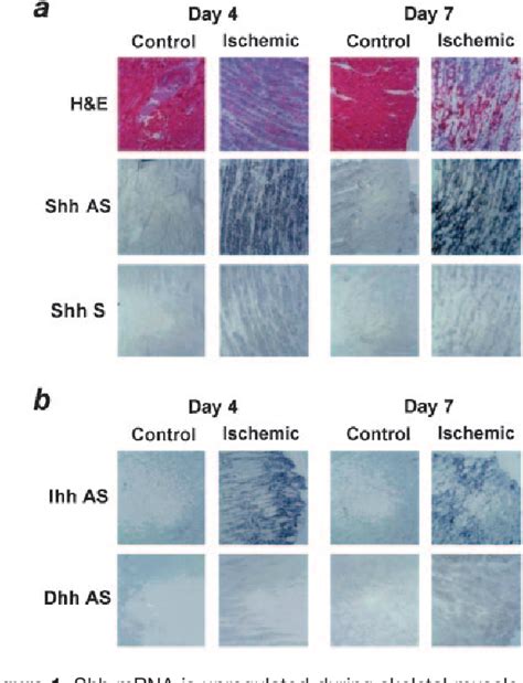 Figure 1 From Postnatal Recapitulation Of Embryonic Hedgehog Pathway In