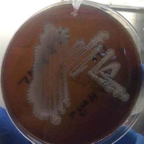 Gram Stain Small Bipolar Gram Negative Bacilli Download Scientific