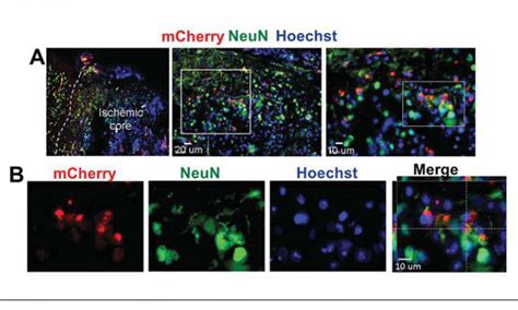 Stem Cell Stimulation Shown To Improve Stroke Recovery
