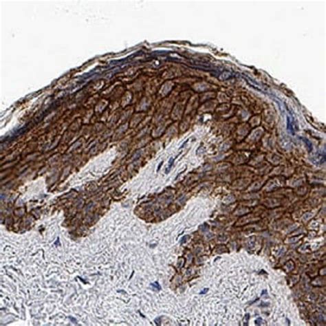 Human Desmoglein 1 Antibody R D Systems 25 μg Unconjugatedantibodies