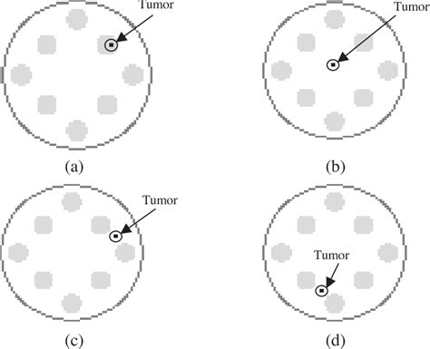 Figure 2 From Breast Cancer Detection Using A Hybrid Finite Difference Frequency Domain And