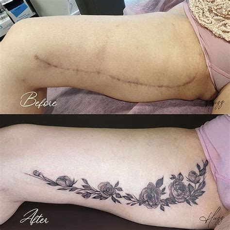 Scars Tattoo Cover Up Artofit