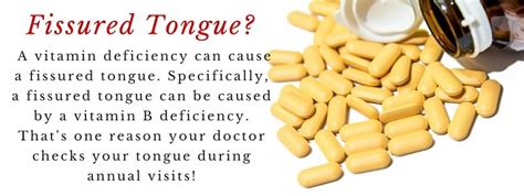 What Exactly Is A Fissured Tongue