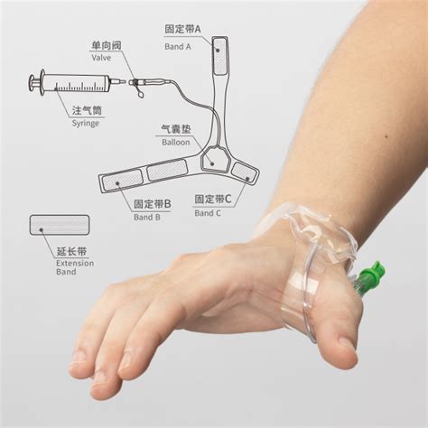 远端桡动脉压迫止血器 Compression Hemostatic Device Interventional Departmentcardiology Consumables
