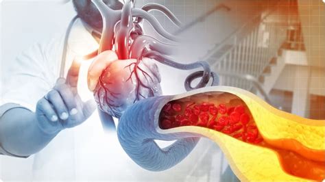Cholesterolकभी भी न हो हाई कोलेस्ट्रॉल की समस्या इसके लिए 20 की उम्र