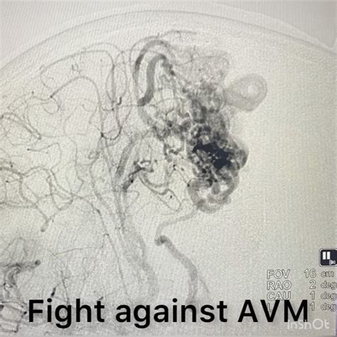 Shingirai Muzondiwa On Linkedin Avms