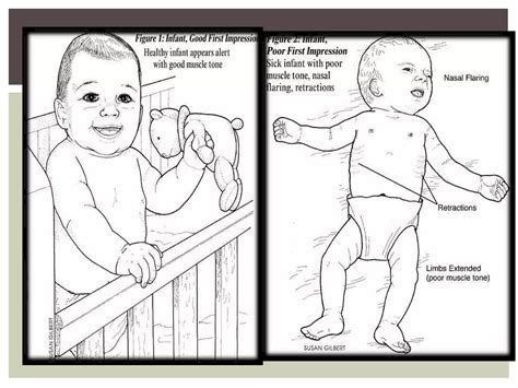 Pediatric Assessment Triangle Ppt