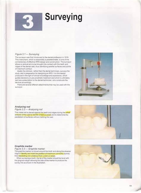 A Clinical Guide To Removable Partial Denture Design Pdf