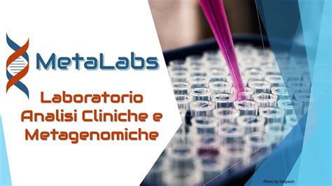 Elta 90 Ms Elta 90 Ms Added A New Photo