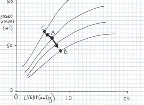 Preload Afterload And Contractility