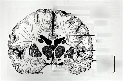 Frontal Section Through Diencephalon Diagram Quizlet