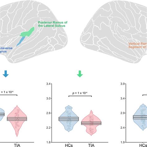 decreased nodal centrality in transient ischemic attack tia compared