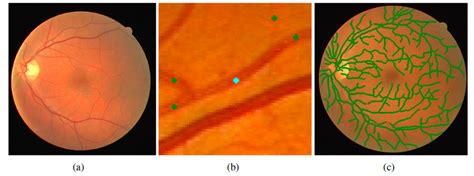 Patch Based Iterative Approach For Vessel Network Topology Extraction