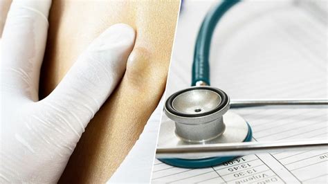 Kyste Comment Reconnaître Le Vôtre Et Savoir Quoi Faire