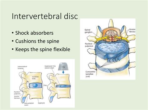 Disc Herniation Pptx