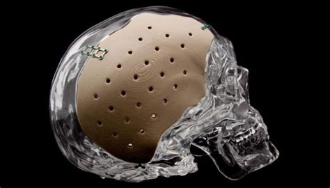 Oxford Performance Materials Aids Ukraine War Victims With 3d Printed