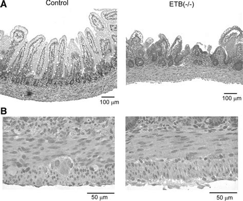 Cross Section Through The Dilated Region Of The Ileum In Etb And