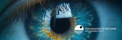 Advanced Eyecare Of Connecticut Aecofct Posts X