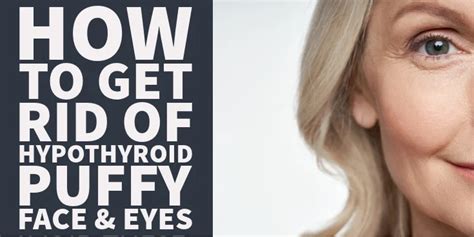 Thyroid Belly Shape What Causes It And How To Get Rid Of It