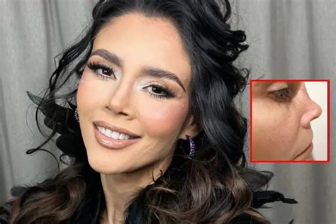 Dorismar Muestra Su Rostro Tras Cirugías Estéticas Pues Fue Desfigurada