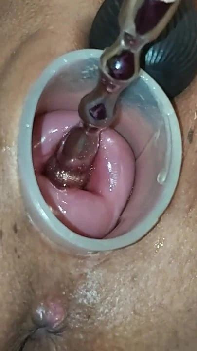 Must See Moment From Inserting My New Toy Deep In My Cervix For You