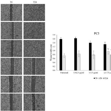 Pc3 Cell Migration Assay Images From A Scratch Assay Experiment At