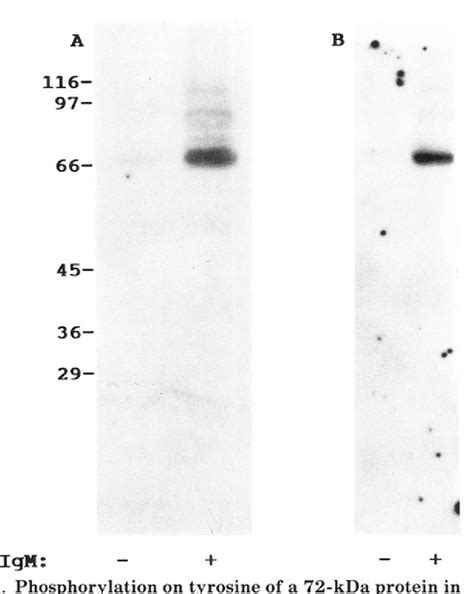 Figure 1 From The Cross Linking Of Membrane Igm On The Surface Of