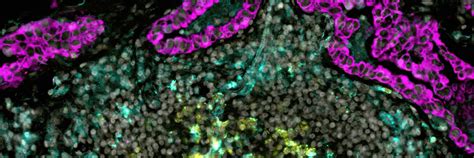 Spatial Biology Applications Nikon Bioimaging Lab Usa Nikon Spatial Biology Applications Nikon Bioimaging Lab Usa Nikon