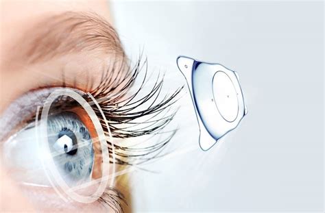 Lasik And Phakic Icl Which One Is Suitable Prima Health