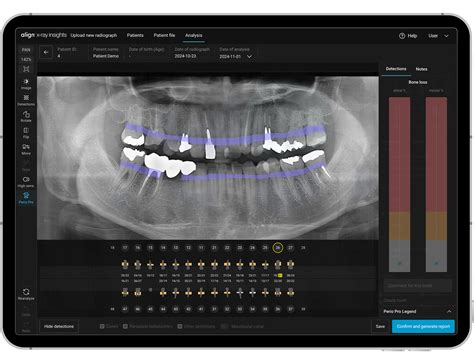 Align Technology Launches Align X Ray Insights An Ai Computer Aided