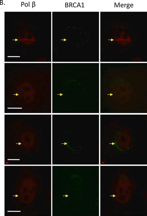 Anti Brca1 Ab 1 Mouse Mab Ms110