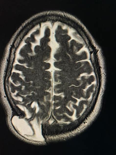 Math Involved In Being A Rad Tech Radiology