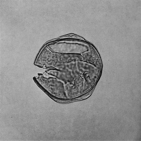 Dinoflagellates Climate Archive And Future Relics Phmuseum