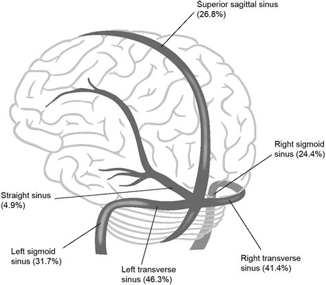 Transverse Sinus Brain
