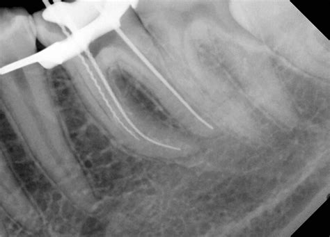 ‎דר אסף ארז מומחה דר אסף ארז מומחה לטיפולי שורש